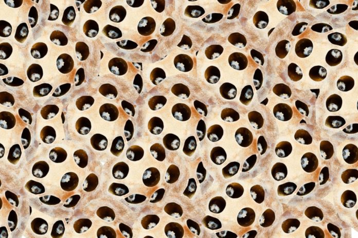 Trypophobie : causes et traitement de la peur des trous - Metamag
